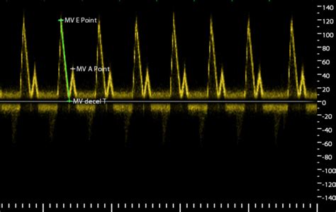 Advanced Echo Module Surgical Science