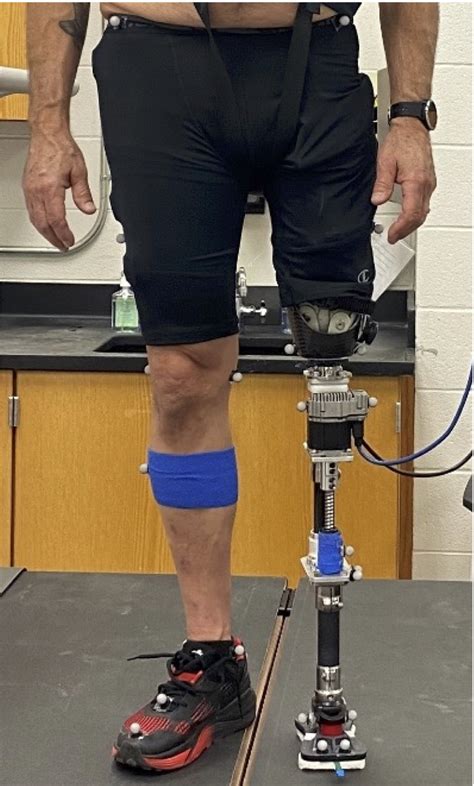 Length Adjustable Prosthesis Based On Dynamic Leg Length Assistive