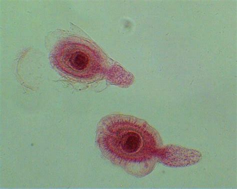 Cestodes Ii Non Taeniid Tapeworms Flashcards Quizlet