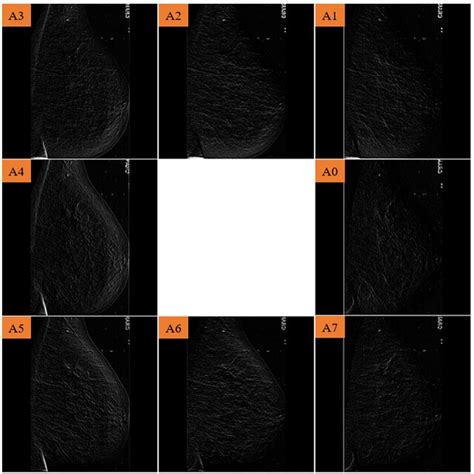 edge detection using kirsch filters the result of applying each of the