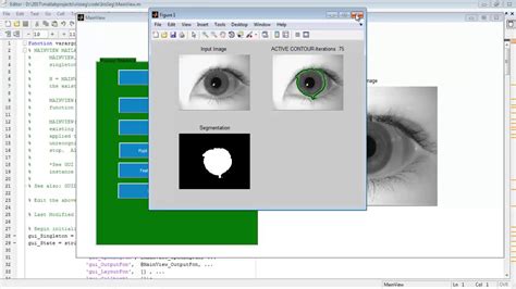Iris Segmentation Matlab Code Projects Youtube