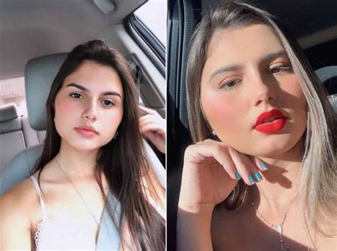 Identical Twins Undergo Sex Change Surgery Together In Brazil