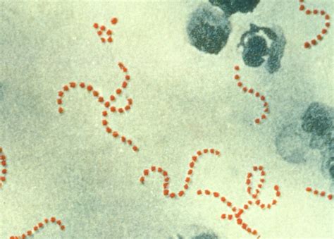 Streptococcus Pyogenes Made For Medical