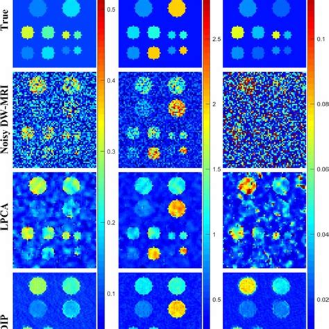 Parametric Maps Of Pf D And D Columns Obtained From Noisy Dw Mri Download Scientific