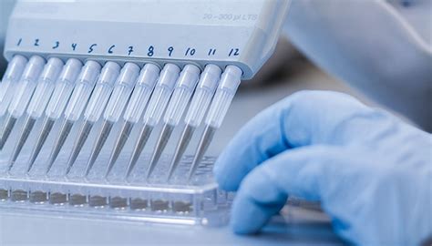 Advanced Bacterial Expression Technology Bioingenium