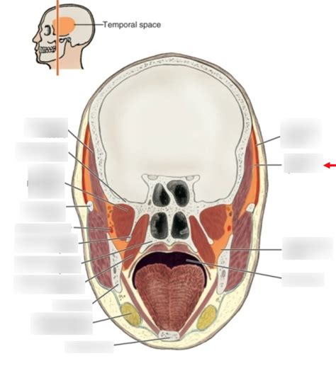 Infratemporal Space A Exposure Of The Infratemporal Fossa Is Achieved