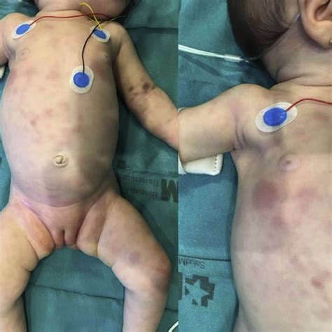 Nodular Skin Lesions Download Scientific Diagram