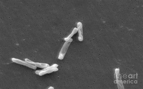 Clostridium Difficile Bacteria Sem Photograph By Science Source Fine Art America