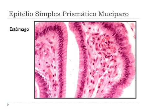 Tecidos Flashcards Memorang Tecidos Flashcards Memorang