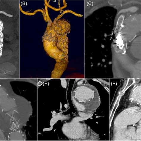 A B Maximum Intensity Projection Mip And Three‐dimensional Download Scientific Diagram