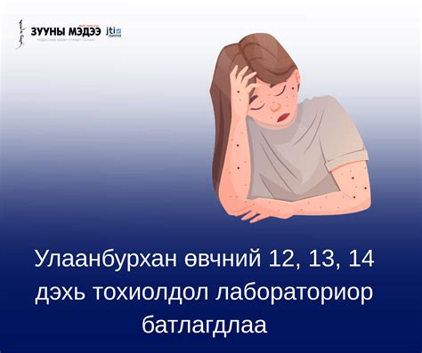 Zuunii Улаанбурхан өвчний 12 13 14 дэхь тохиолдол лабораториор