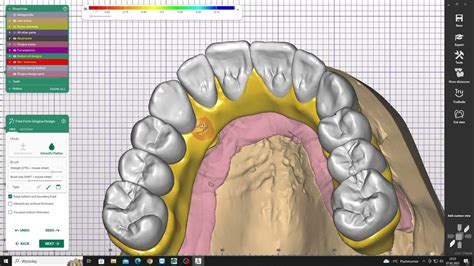 How To Design In Exocad All On Six With Cutback Youtube