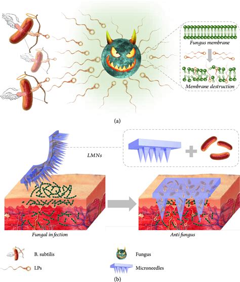 Skin Abscess Diagram