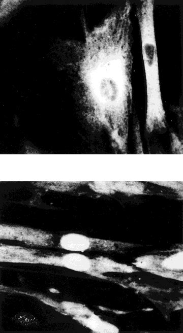 Intracellular Localization Of Gapdh In Proliferating Normal Human Cells