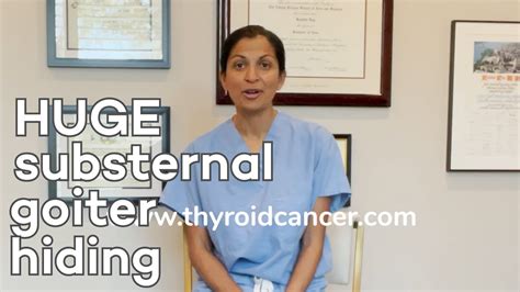 Substernal Goiter Hiding In Womans Chest Avoids Sternotomy By Having