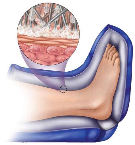 Prevalon® Pressure Relieving Boots Iskus Health