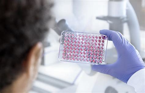 Julia Oster On Linkedin High Throughput Assays With Permeable Membrane