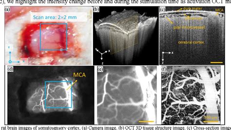 Figure 1 From Functional Optical Imaging Of Neurovascular Activation In The Rat Cerebral Cortex