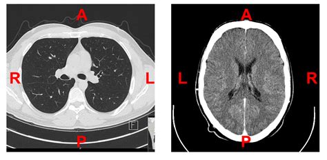 Writing A Niftinii Reader In Python By Ashkan Pakzad Medium