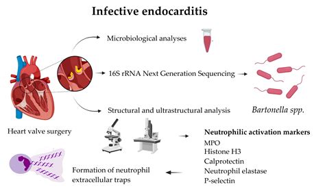 Bacterial Endocarditis Infective