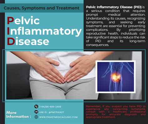 Pelvic Inflammatory Disease Pid Causes Symptoms And Treatment