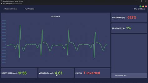 A Simple Web Based Ecg Visualization Tool Built With Angularjs Youtube