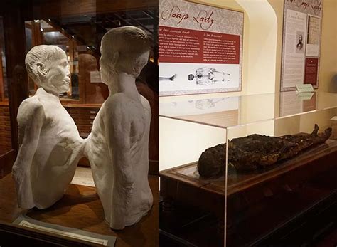 Soap Woman Mutter Museum