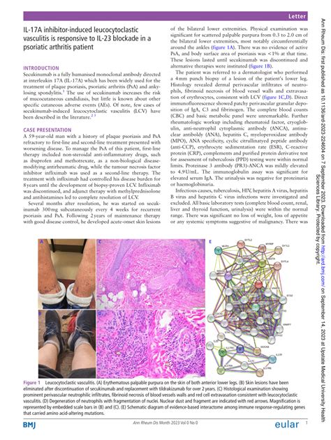 Pdf Il 17a Inhibitor Induced Leucocytoclastic Vasculitis Is