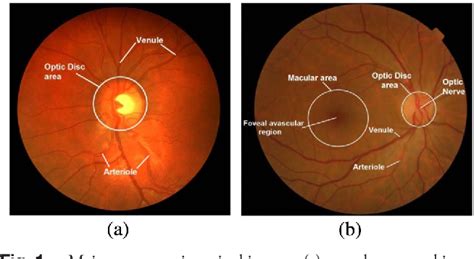 Figure 1 From Optic Disc Detection And Boundary Extraction In Retinal