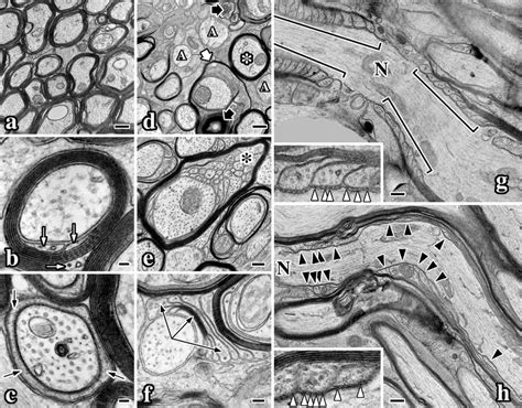 Cns Myelin Ultrastructural Abnormalities In Nkx6 2 Null Mice Electron Download Scientific