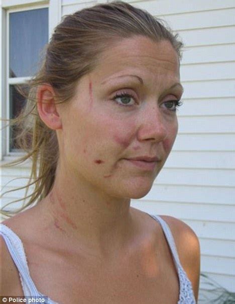 Former Calumet County District Attorney Kenneth Kratz Says Sex And Drug Additions Were Behind