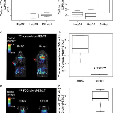 Dual Tracer Uptake In Three Hcc Cell Lines In Vitro And In Vivo In