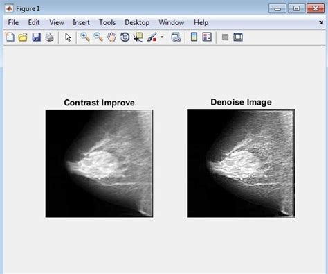 Preprocessing Technique Download Scientific Diagram