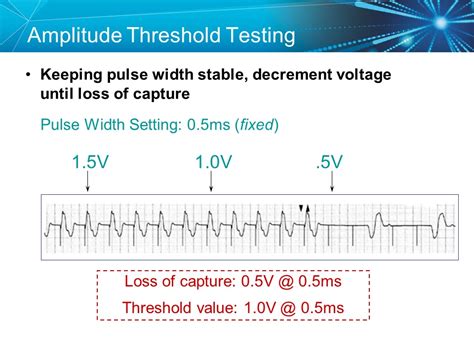 Cvt Mohd Farid Pacemaker Follow Up Part Ii Medtronic Academy