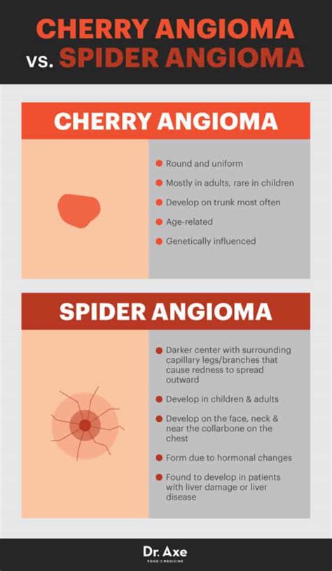 Cherry Angioma Risk Factors Symptoms And Natural Treatments Dr Axe