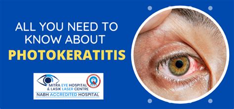 What Causes Photokeratities What Are The Risk Factors And Symptoms Of