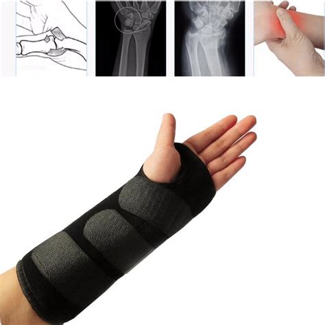 Ulnar Styloid Fracture Splint
