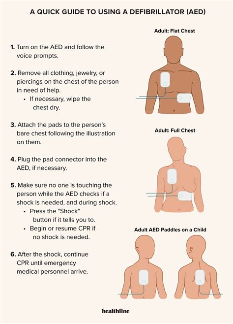 Best 13 How To Use A Defibrillator Steps And Faq Artofit