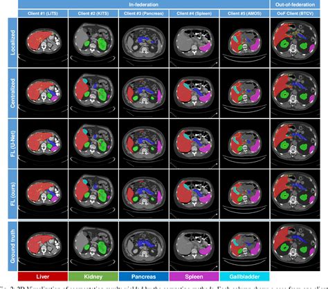 Figure 2 From Federated Multi Organ Segmentation With Inconsistent Labels Semantic Scholar