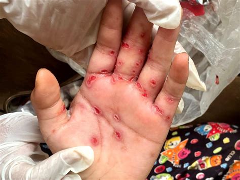 ပွန်ချောင်း အမှတ် ၄ စစ်ဘေးရှောင်စခန်းမှာ ကျောင်းနေအရွယ်ကလေးတွေ အရေပ