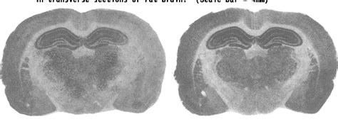 Figure 1 From A Primate Model For The Assessment Of Anxiolytic Drug