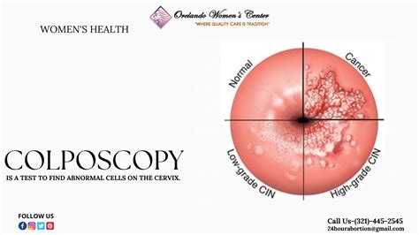 Abnormal Pap Colposcopy Biopsy