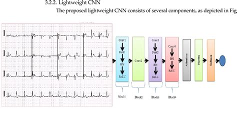 Figure 7 From Efficient Classification Of Ecg Images Using A Lightweight Cnn With Attention