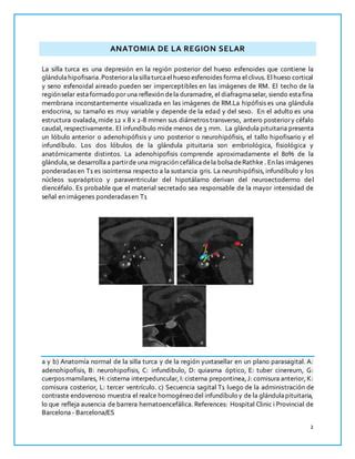 Anatomía De La Cisterna Supraselar