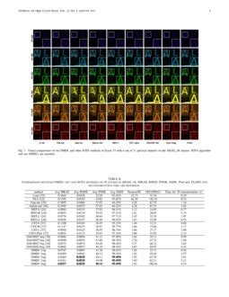 DMDC Dynamic Mask Based Dual Camera Design For Snapshot Hyperspectral