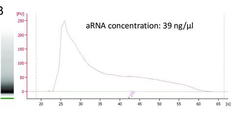 Figure S2 Bioanalyser Rna Integrity Test Representative Results Download Scientific Diagram
