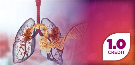 Updated Imwg Guidelines Spotlight Mrd Functional Imaging And Light