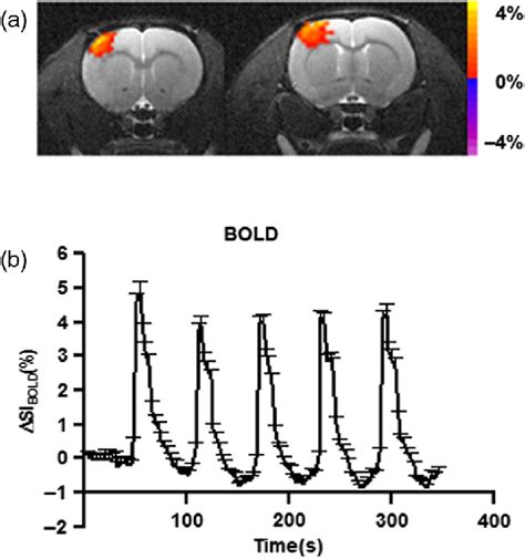 A Bold Fmri Activation Map During Right Forepaw Stimulation