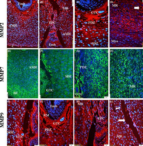 The Immunolocalization Of Mmps In The Rat Endometrium During Pregnancy