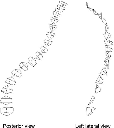 Figure 1 From Three Dimensional 3 D Reconstruction Of The Spine From A Single X Ray Image And